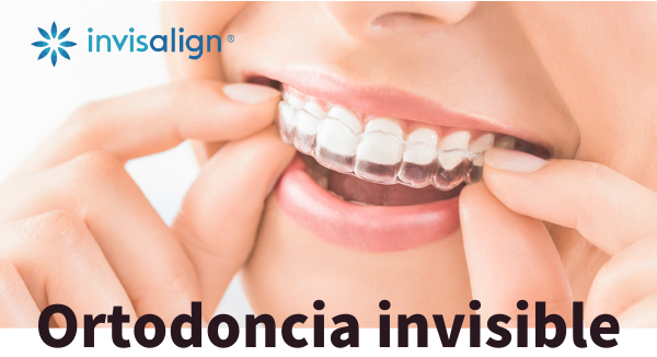 Cómo limpiar bien tu ortodoncia (brackets y alineadores transparentes ...